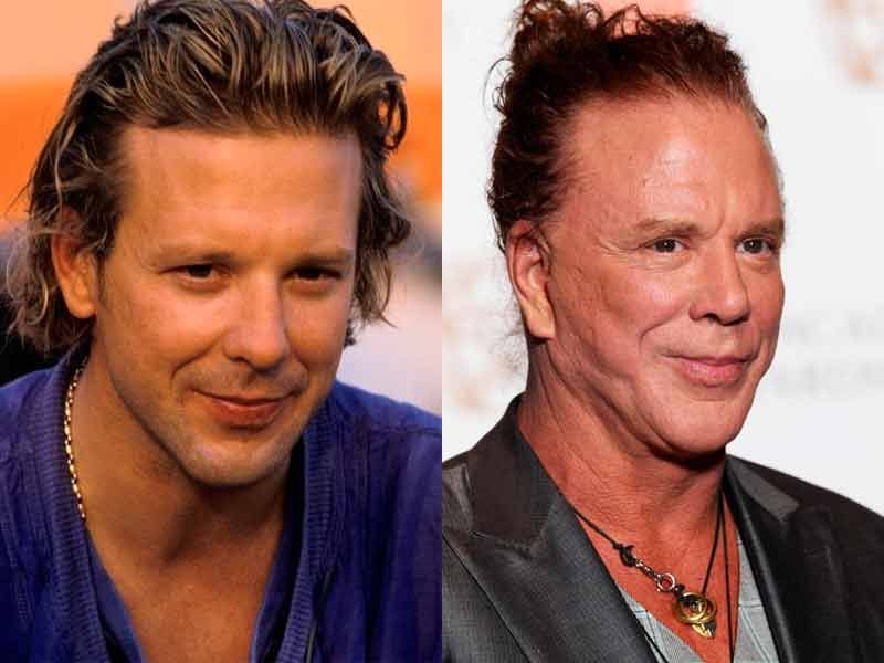 20 actores antes y después de pasar por quirófano: Mickey Rourke ...